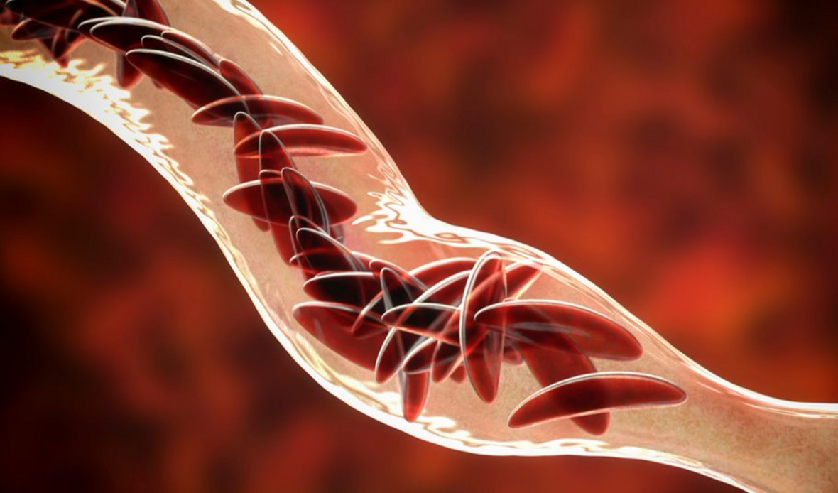 Was Nimmt Man Bei Eisenmangel