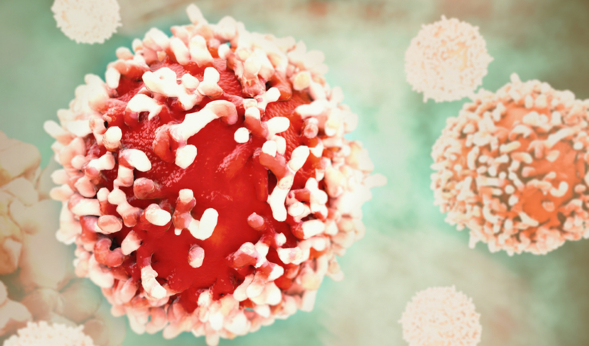 Neue Therapieansätze für bösartigen Knochenkrebs | CredoWeb