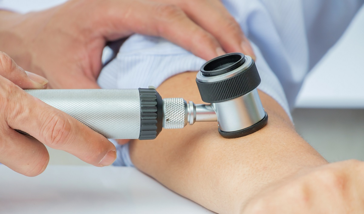 Pediatric Acute Generalized Exanthematous Pustulosis Involving ...