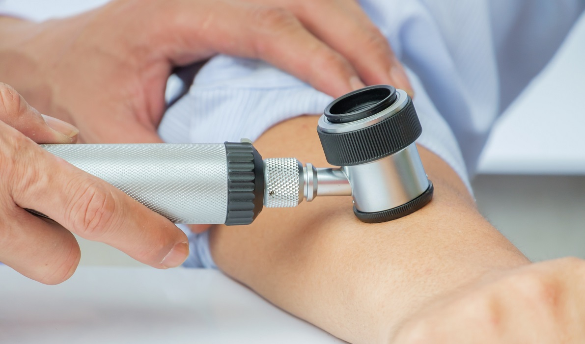 Median Canaliform Dystrophy of Heller Affecting Multiple Nails: A Rare ...